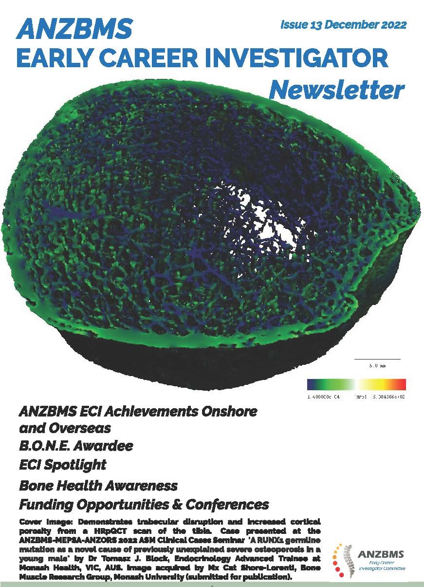 ANZBMS - Newsletter